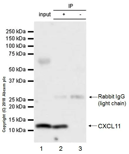 Recombinant human Interferon gamma protein (Active) (ab9659) | Abcam