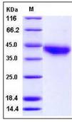 Recombinant Human JAML protein (His tag) (ab276204) | Abcam