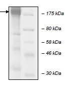 Recombinant human KDM5C / Jarid1C / SMCX protein (ab196392) | Abcam