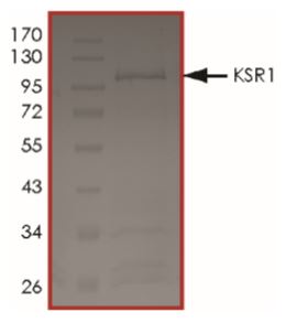 Recombinant Human KSR1 protein (Tagged) (ab268719) | Abcam