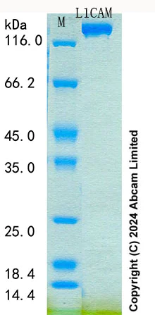 Recombinant Human L1CAM Protein Standard (His tag) (ab316491) | Abcam