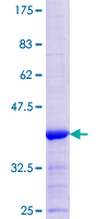 Recombinant Human LAD1 protein (ab116948) | Abcam