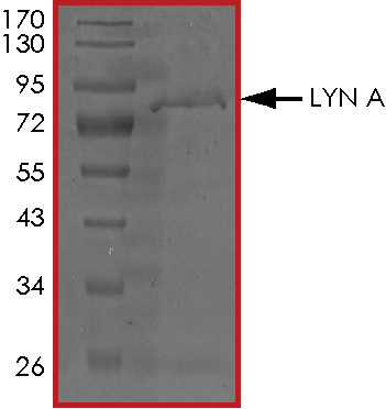 Recombinant human Lyn protein (ab70789) | Abcam