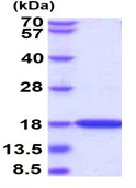 Recombinant Human MAP1LC3A protein (ab98119) | Abcam