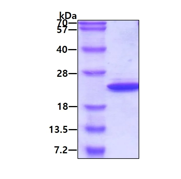 Recombinant Human MAX protein (ab95309) | Abcam