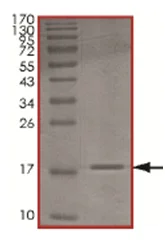 Recombinant Human MMS2 protein (ab167920) | Abcam
