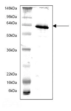 Recombinant Human Monoamine Oxidase B/MAOB protein (ab82944) | Abcam