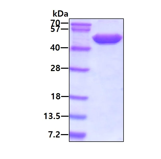 Recombinant Human NSE protein (ab78797) | Abcam