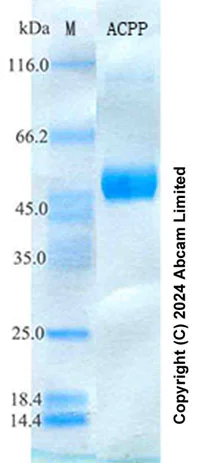 Recombinant Human PAP Protein Standard (His tag) (ab316614) | Abcam
