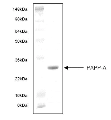 Recombinant Human PAPP A protein (ab53389) | Abcam