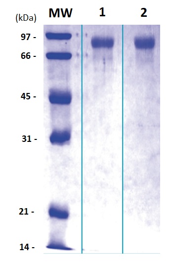 Recombinant Human PI-16 protein (ab117229) | Abcam