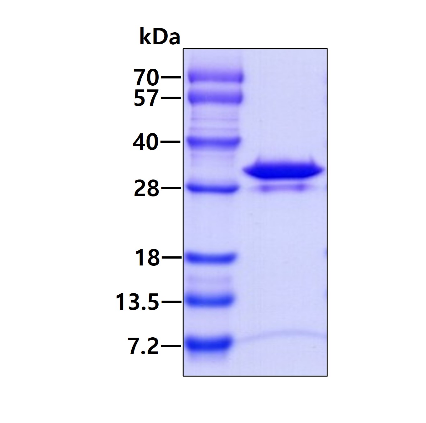 Recombinant Human PMM2 protein (ab99391) | Abcam