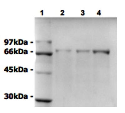 Recombinant Human Progerin protein (ab93918) | Abcam