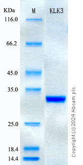 Recombinant Human PSA Protein Standard (His tag) (ab316577) | Abcam