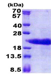 Recombinant Human PTMA protein (ab171705) | Abcam