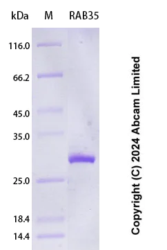 Recombinant Human RAB35 Protein Standard (His tag) (ab323096) | Abcam