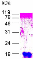 Recombinant Human RhD protein (ab80087) | Abcam