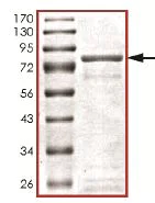 Recombinant human ROR1 protein (ab140807) | Abcam