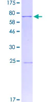 Recombinant Human SGCE/ESG protein (ab160261) | Abcam