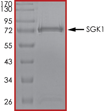 Recombinant human SGK1 protein (ab60883) | Abcam