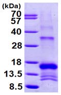 Recombinant Human SLPI protein (ab99142) | Abcam
