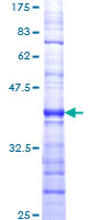 Recombinant Human Smg1 protein (ab161516) | Abcam