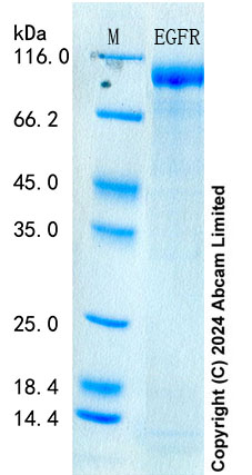 Recombinant Human soluble EGFR Protein Standard (His tag) (ab316615 ...