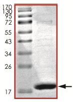 Recombinant Human Stathmin 1 protein (ab125559) | Abcam