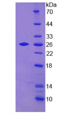 Recombinant Human TAGLN2 protein (His tag) (ab275568) | Abcam