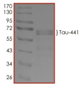 Recombinant Human Tau (phospho ) protein (ab269022) | Abcam