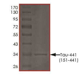 Recombinant Human Tau protein (ab268995) | Abcam