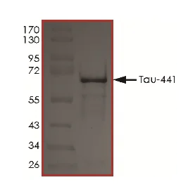 Recombinant Human Tau441 protein (ab191460) | Abcam