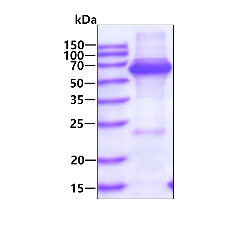 Recombinant Human TCP1 alpha/CCTA protein (ab101043) | Abcam