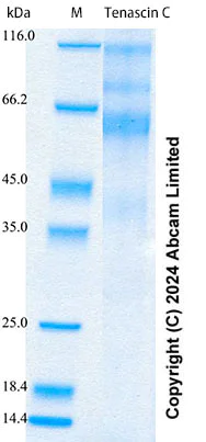 Recombinant Human Tenascin C Protein Standard (His tag) (ab322746) | Abcam