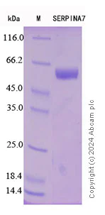 Recombinant Human Thyroxine Binding Globulin Protein Standard (His tag ...