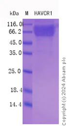 Recombinant Human TIM 1 Protein Standard (His tag) (ab316448) | Abcam