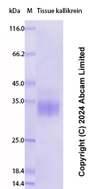 Recombinant Human Tissue kallikrein Protein Standard (ab323052) | Abcam