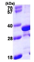 Recombinant Human TPM4 protein (ab105576) | Abcam