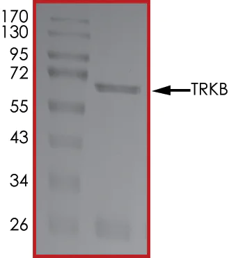 Recombinant human TrkB protein (ab56652) | Abcam
