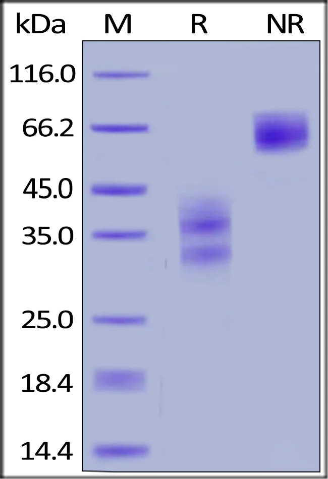 Recombinant human TWEAKR/FN14 protein (Fc Chimera) (ab182702) | Abcam