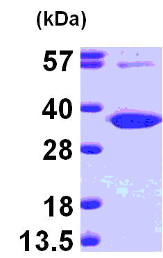 Recombinant Human Uridine Phosphorylase 1 protein (ab101152) | Abcam