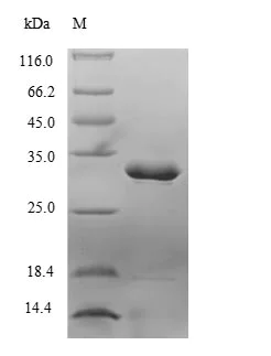 重组Limulus clotting factor c蛋白(Tagged) (ab236802)| Abcam中文官网