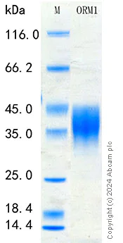 Recombinant Mouse alpha 1 acid Glycoprotein Protein Standard (His tag ...