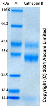 Recombinant Mouse Cathepsin B Protein Standard (His tag) (ab322754) | Abcam
