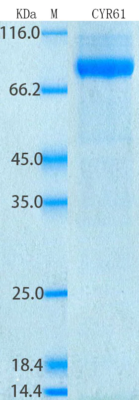 Recombinant Mouse CYR61 Protein Standard (His tag) (ab316428) | Abcam