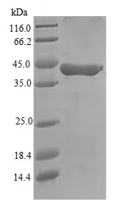 Recombinant Mouse Granzyme A protein (His tag) (ab226310) | Abcam