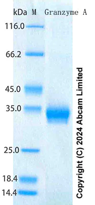 Recombinant Mouse Granzyme A Protein Standard (His tag) (ab316668) | Abcam