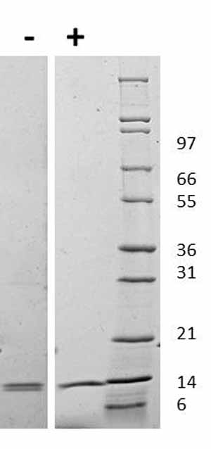Recombinant mouse IL-31 protein (ab119155) | Abcam