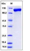 Recombinant Mouse LRIG1 protein (His tag) (ab276863) | Abcam