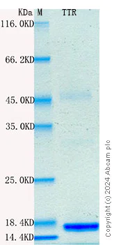 Recombinant Mouse Prealbumin Protein Standard (His tag) (ab319985) | Abcam